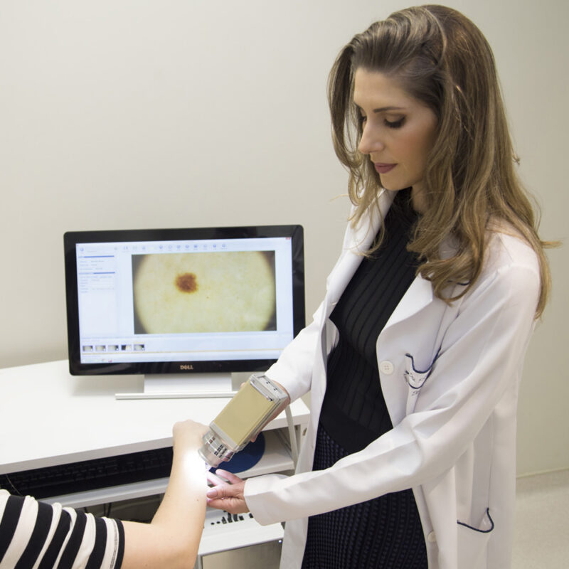 Dermatoscopia Digital: Exame de pintas e manchas na pele - Detecção ...